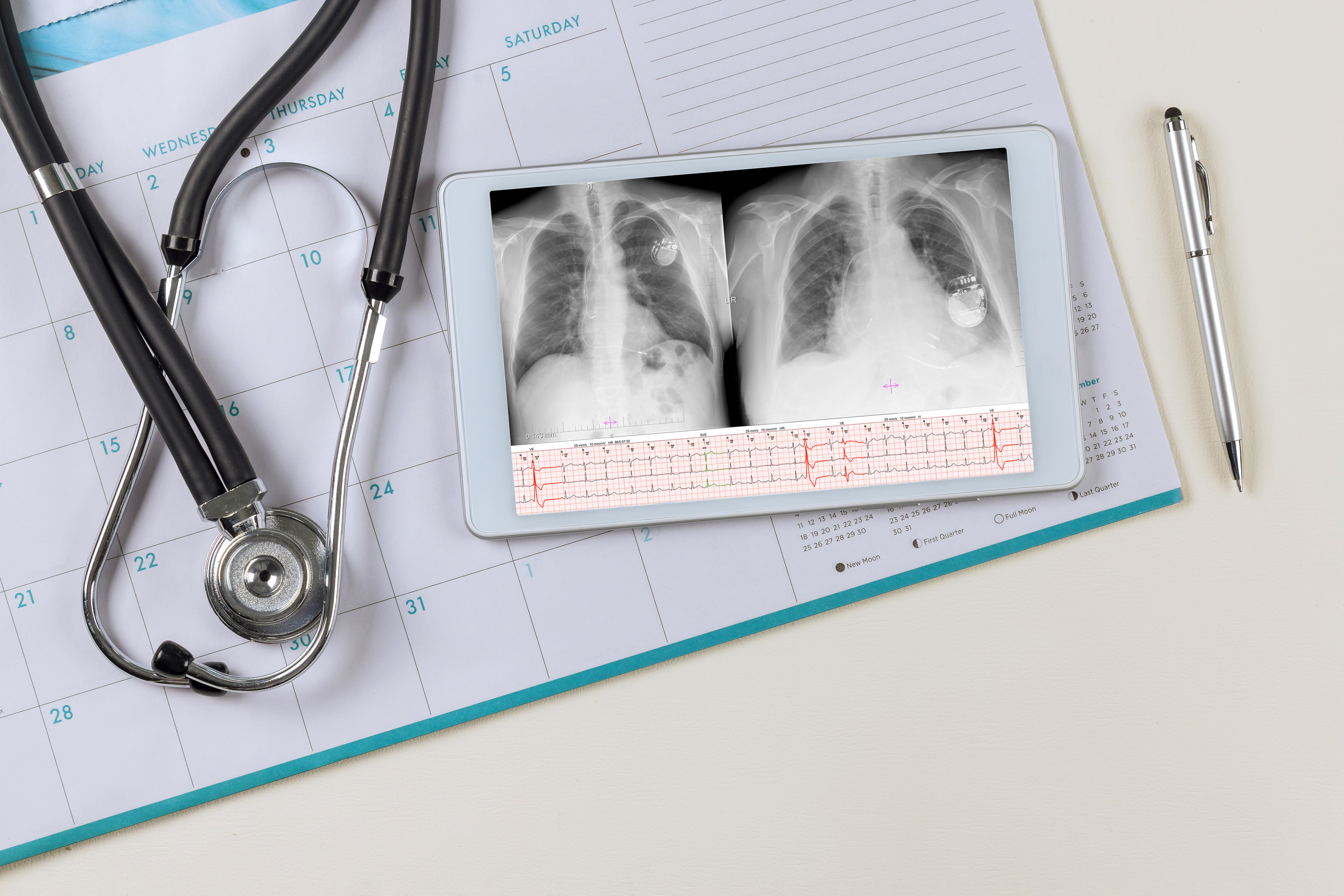 How Is Lung Cancer Diagnosed: What to Expect | Phoenix CyberKnife ...